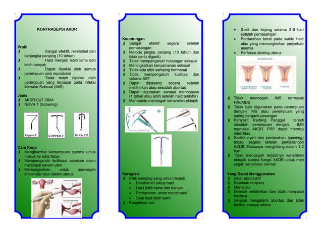 Alat Kontrasepsi Dalam Rahim (AKDR) | PPT