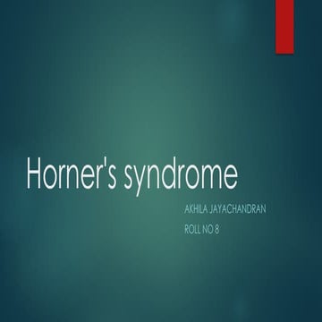 horners syndrome medicine and surgery ppt | PPTX