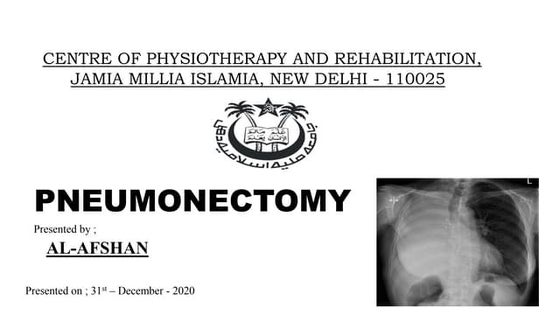 Thoracotomy | PPTX