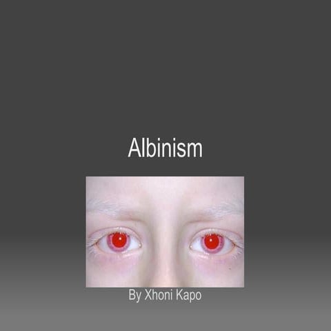 Albinism | PDF