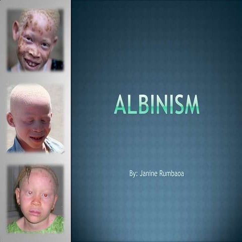 Albinism | PPTX