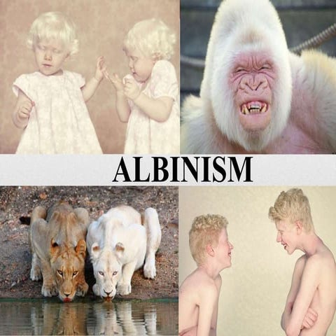 Albinism | PPT