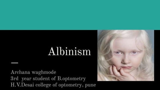 Albinism powerpoint[1] | PPT | Eye and Vision Conditions | Diseases and ...