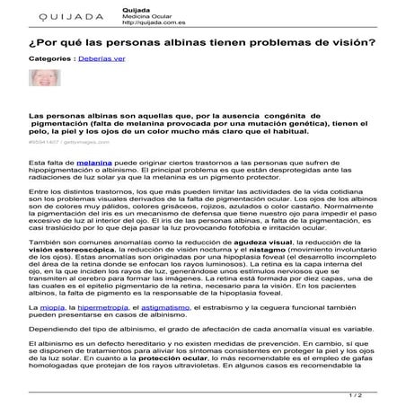 Albinismo | PDF