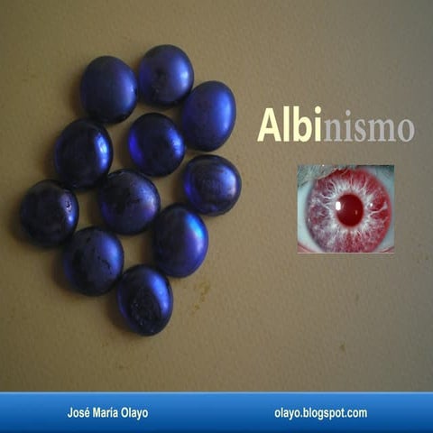 Albinismo | DOCX