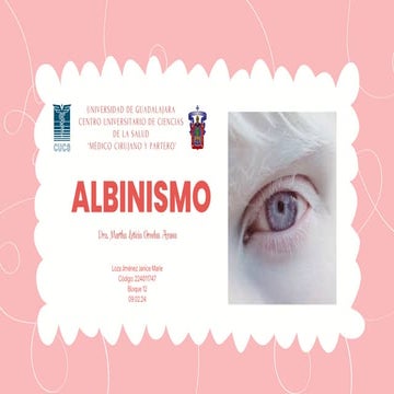 Albinismo | PPTX
