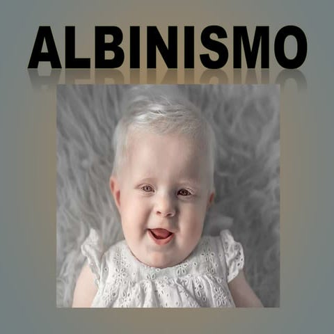 Albinismo | PPTX