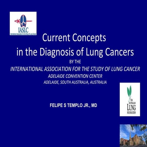 Current Concepts in the Diagnosis of Lung Cancer | PPT