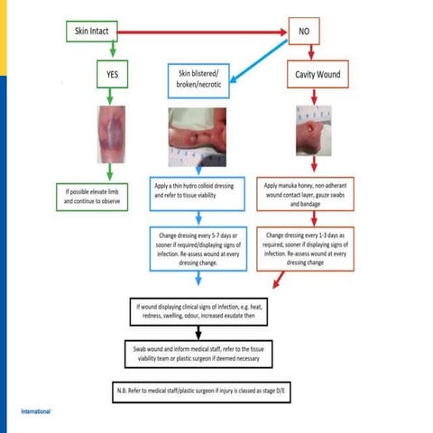 Algorithm of Contrast Extravasation 1.pptx