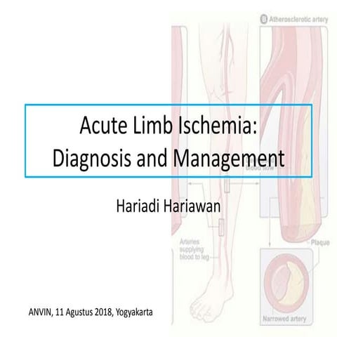 22.2.2018 acute limb ischemia vs critical limb ischemia | PPTX