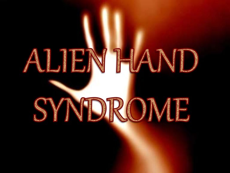 Alien hand syndrome presentation