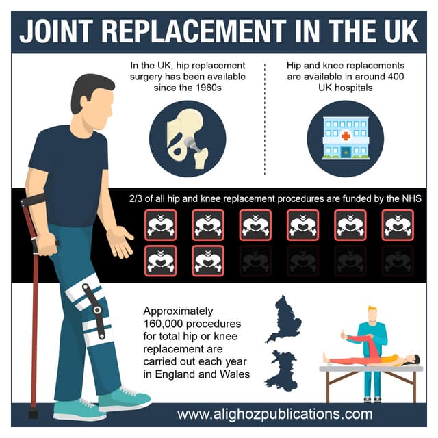 Joint Replacement Statistics - UK | PDF