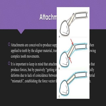 Aligner biomech-1.pptx biomechanics, orthodontics | PPTX