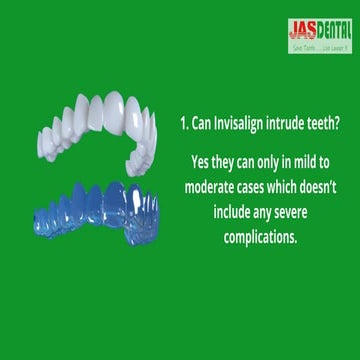 Aligners ppt | PDF