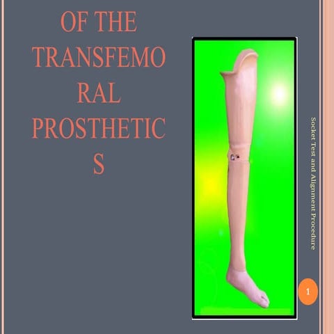 Alignment of Transfemoral prosthesis, TF | PPT