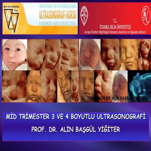 MİD TRİMESTER 3 VE 4 BOYUTLU USG | PDF