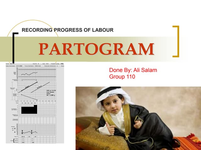 Partogram | PPT