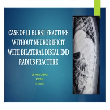 ALKESH L1 FRACTURE spine presentation.pptx