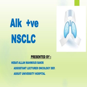 Alk +ve nsclc | PPTX