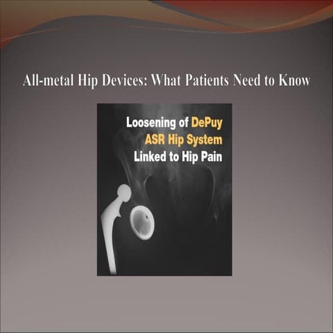 Pttd powerpoint | PPTX