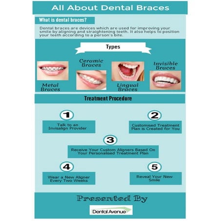 All About Dental Braces | PDF
