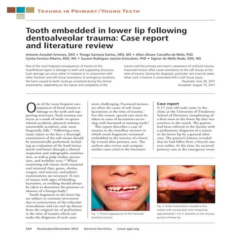 31.embedded and impacted teeth | PPTX