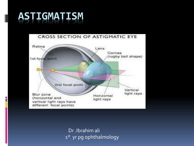 Astigmatic fan