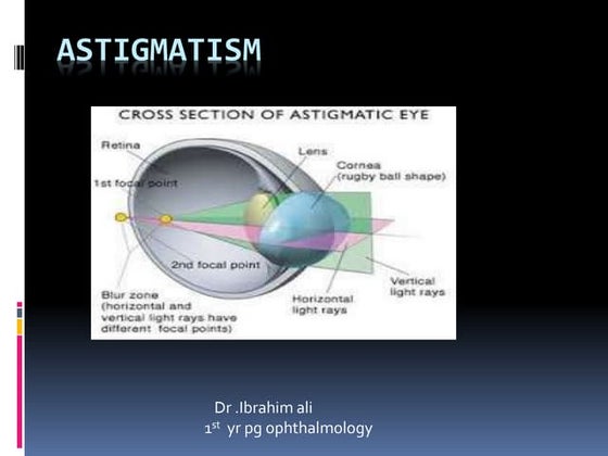 asigmatic clock and fan .pdf | Eye and Vision Conditions | Diseases and ...