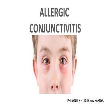 Allergic Conjunctivitis - Dr Arnav Saroya | PPTX