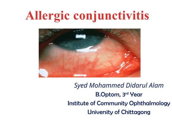 ALLERGIC CONJUNCTIVITIS.pptx