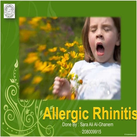 Allergic rhinitis | PPTX