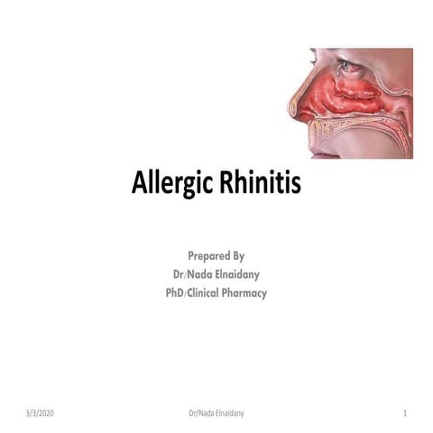 Allergic rhinitis | PPT
