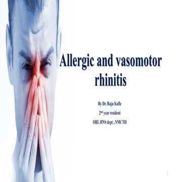 Allergic rhinitis - presentation | PPTX
