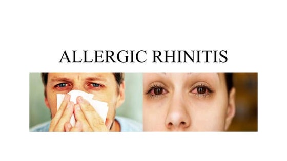 Allergic rhinitis - presentation | PPTX | Allergies | Diseases and ...