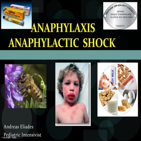 Allergic shock | PPTX