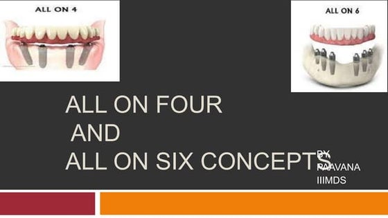 Impression Taking Components for Straumann | PDF