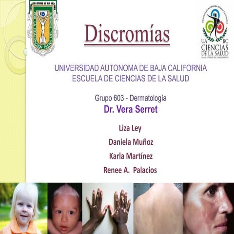 Discromias [Albinismo, Argiria] Enf. Psicosomaticas [Alopecia Areata ...