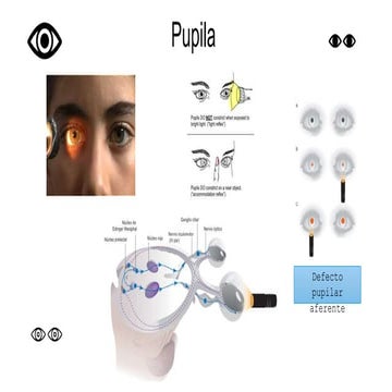 ALTERACIONES DE PUPILA, Oftalmologia medicina | PPTX