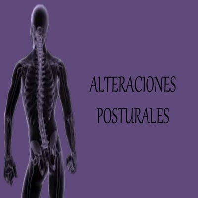 ALTERACIONES POSTURALES.pptx