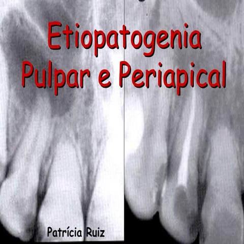 Alterações Pulpares e Periapicais.pdf | Dental Health | Diseases and ...