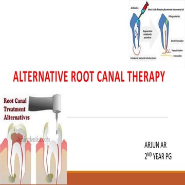 Alternative Root Canal Therapy | PPTX