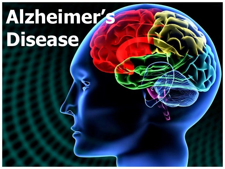 Alzheimer’s disease: Management