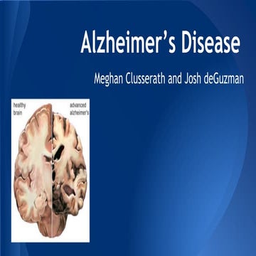 Alzheimer's Disease Presentation | PPTX