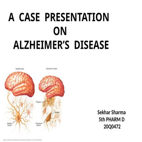 A Case a presentation on Alzheimer Diseases | PPTX