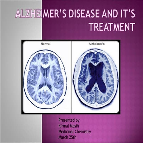 Alzheimers presentation.docx (1) | PPT