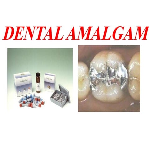 Dental Porcelain lecture for first year dental students.ppt