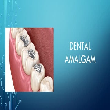 dental amalgam 2- advantage disadvantage | PPTX