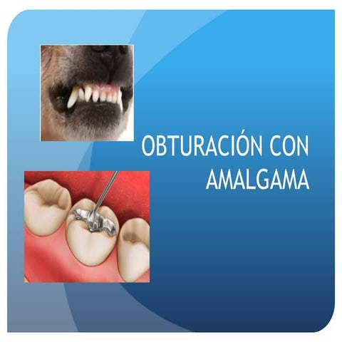 Amalgama oliberts | PPT