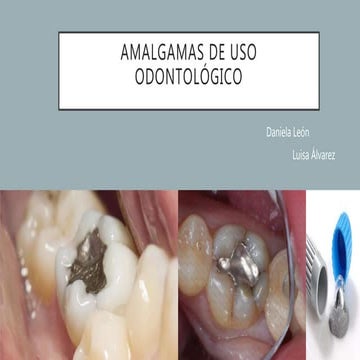 Amalgamas | PPTX