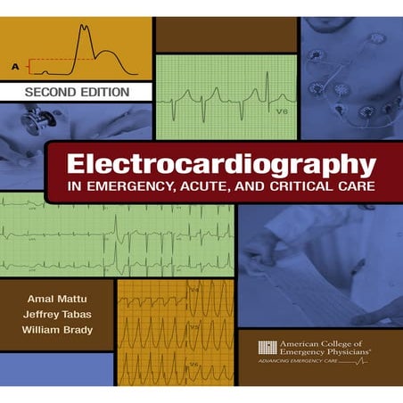 _Amal_Mattu__Jeffrey_A._Tabas_-_Electrocardiography_in_Emergency__Acute ...